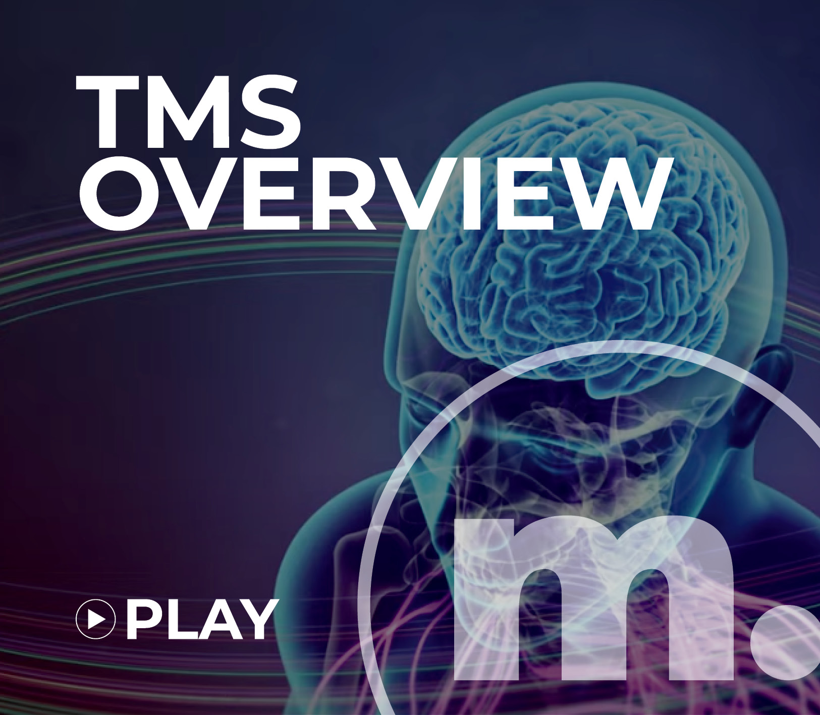 Magstim TMS Overview - Magstim
